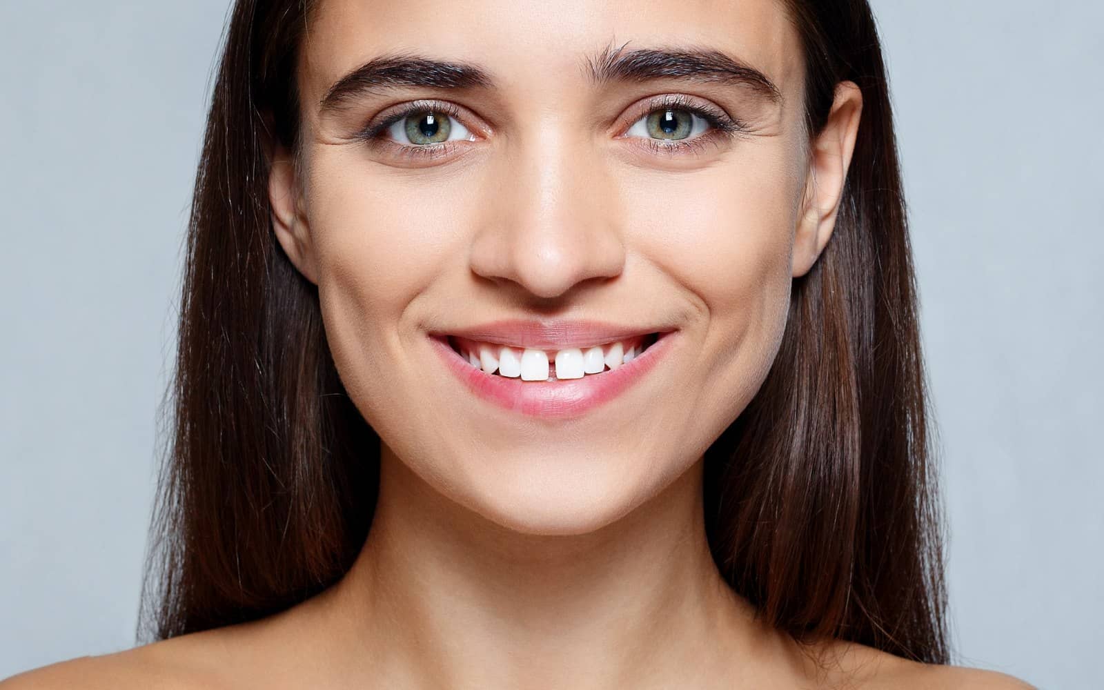 Les Facettes Dentaires Une Solution Pour Corriger Les Dents Du